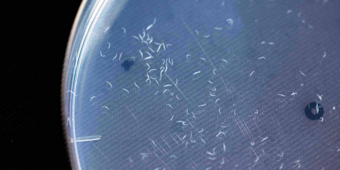 These tiny worms can detect pancreatic cancer with great accuracy ...