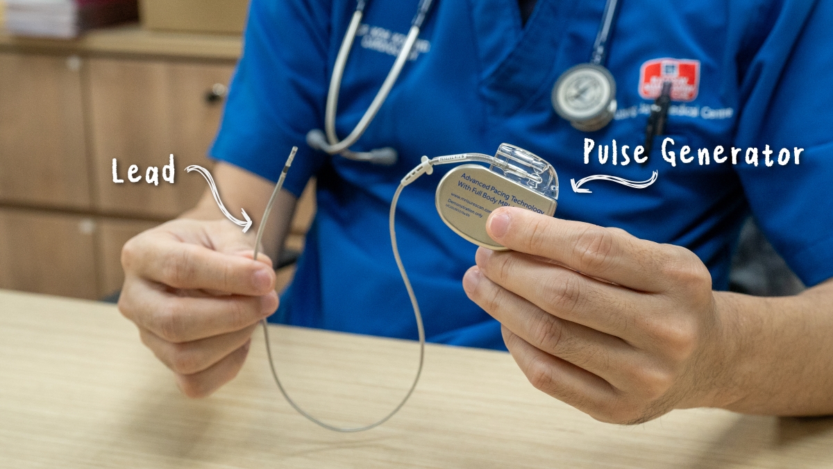 We talk to an electrophysiologist about heart arrhythmia