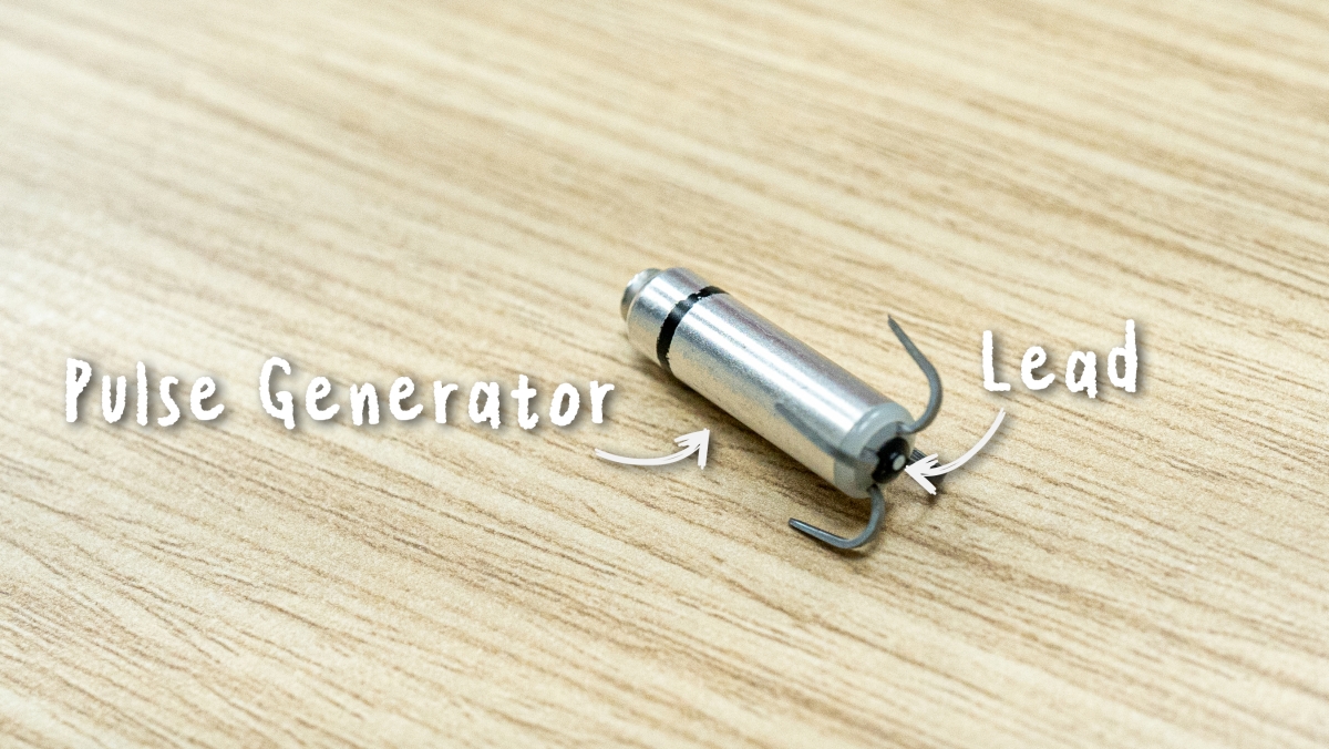 We talk to an electrophysiologist about heart arrhythmia