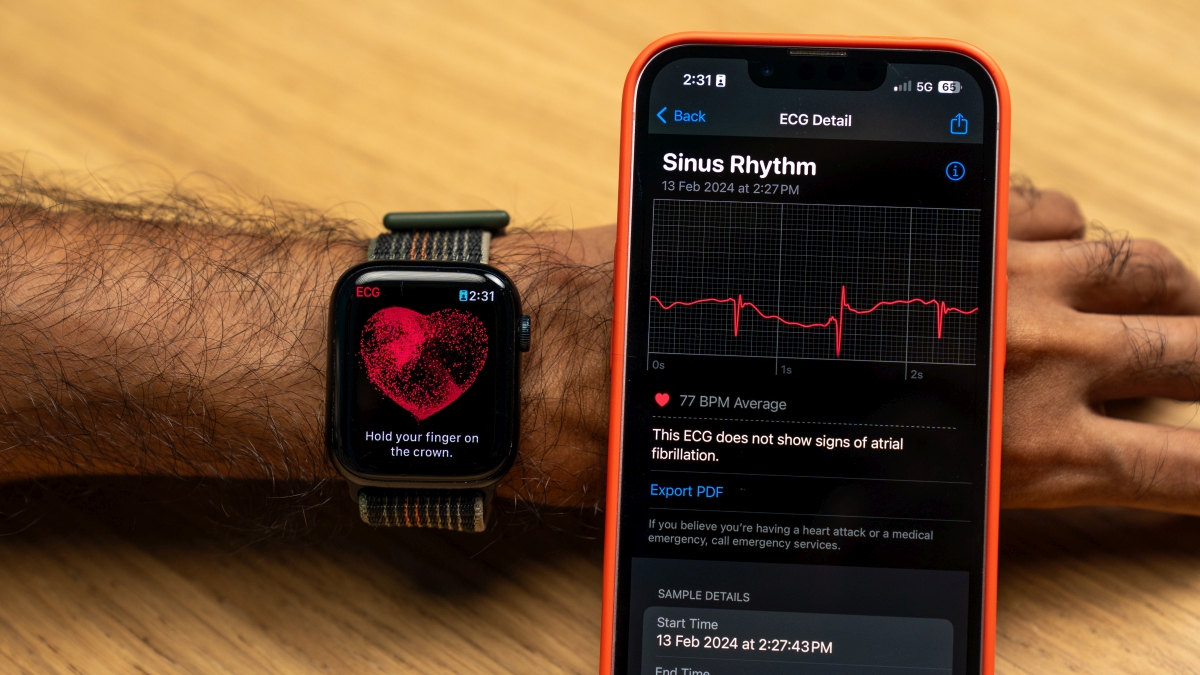 We talk to an electrophysiologist about heart arrhythmia