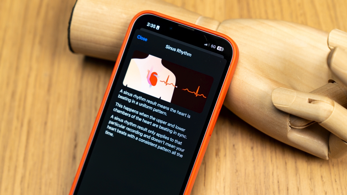 We talk to an electrophysiologist about heart arrhythmia